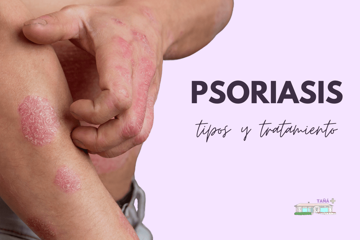 ¿Qué es la Psoriasis? Tipos y Tratamiento - El Blog Tañá